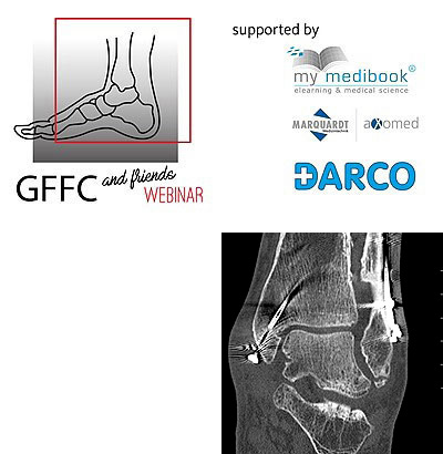 GFFC and friends - Gesellschaft für Fuß- und Sprunggelenkchirurgie e.V.
